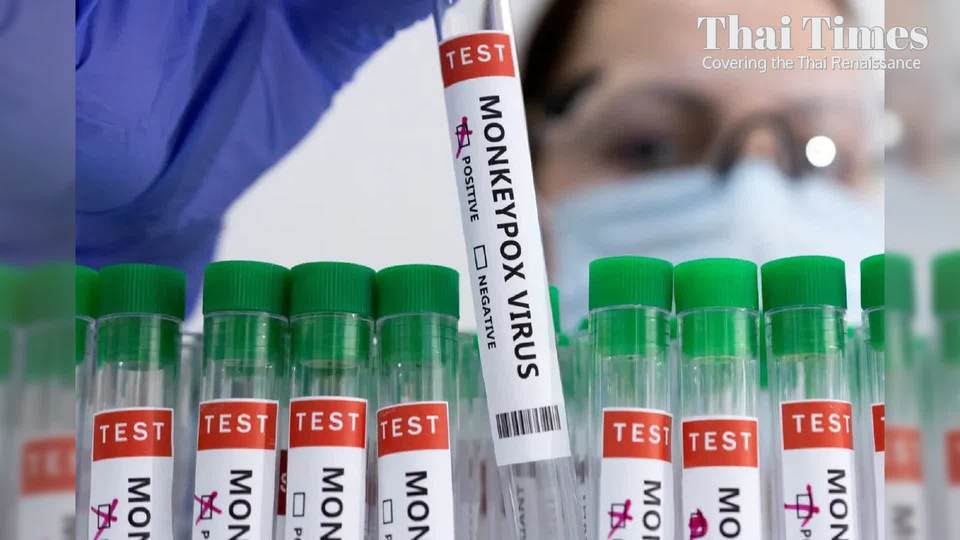 FDA Expedites Approval for Mpox Diagnostic Kits - Thai Times